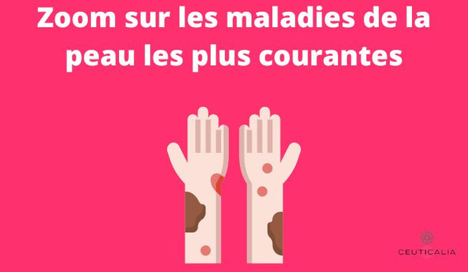 Zoom sur les Maladies de la Peau les Plus Courantes – Ceuticalia