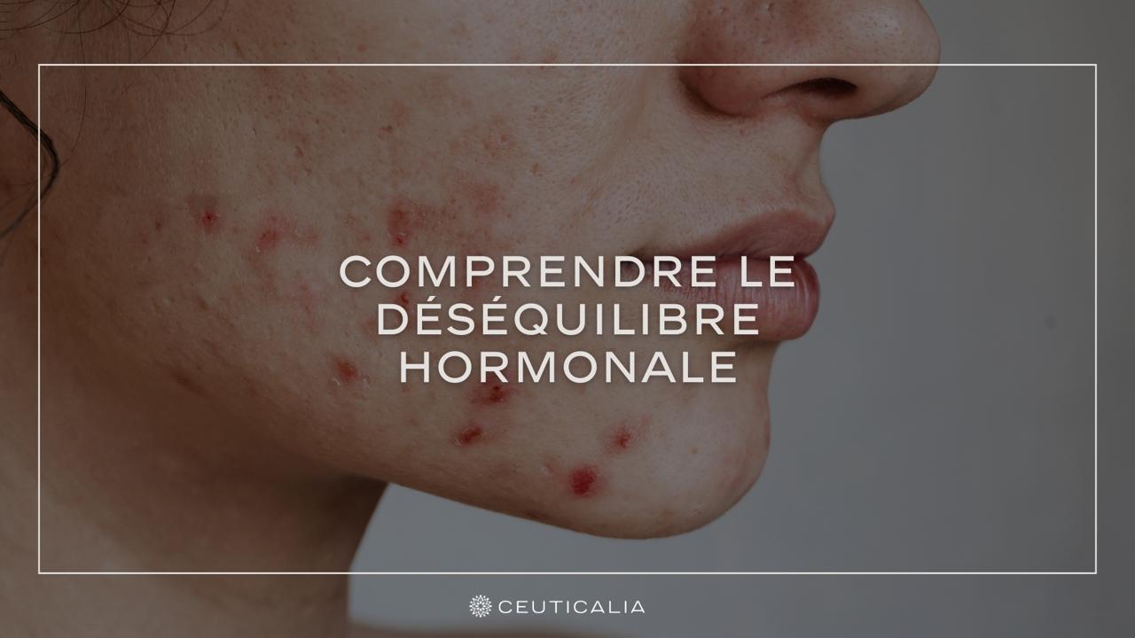 Comprendre le Déséquilibre Hormonal – Ceuticalia