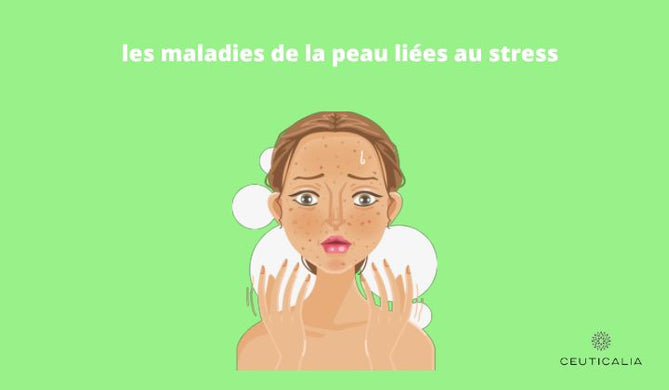Les Maladies de la Peau Liées au Stress – Ceuticalia