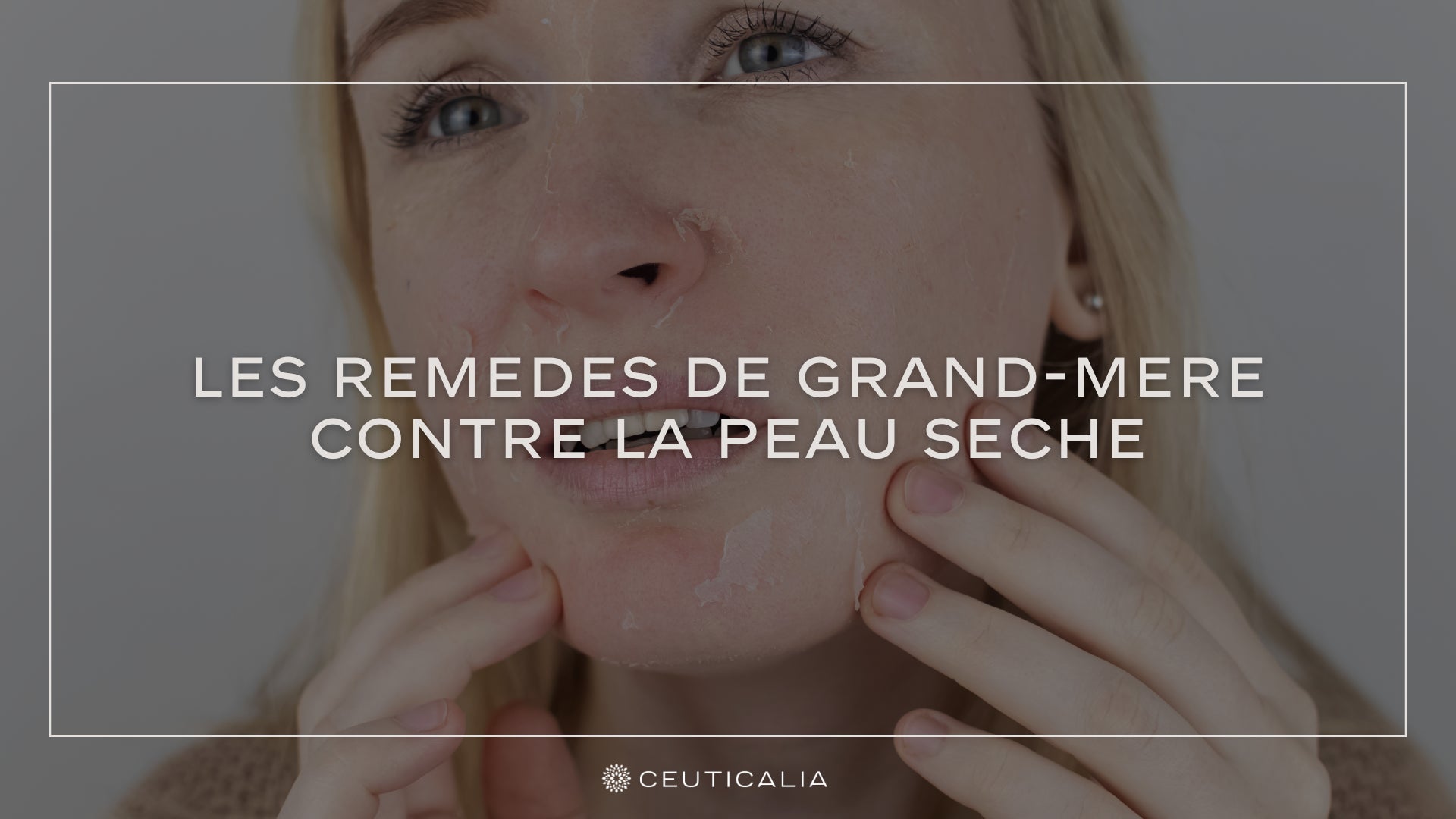 Les Remèdes de Grand-Mère contre la Peau Sèche – Ceuticalia